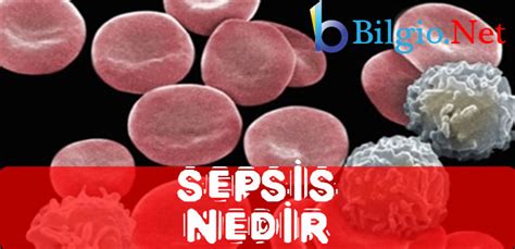Sepsis Nedir Bilgio Net