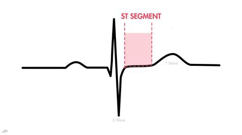 The Cardiac Cycle P QRS T Nucleotype