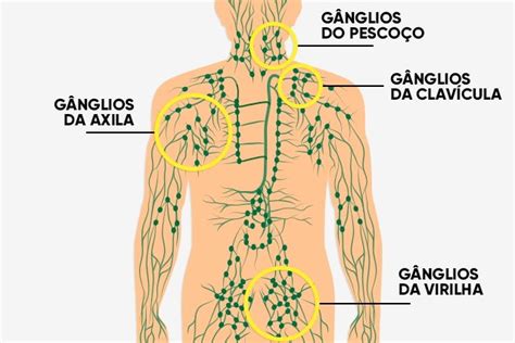 Qué son los ganglios linfáticos para qué sirven y dónde se localizan