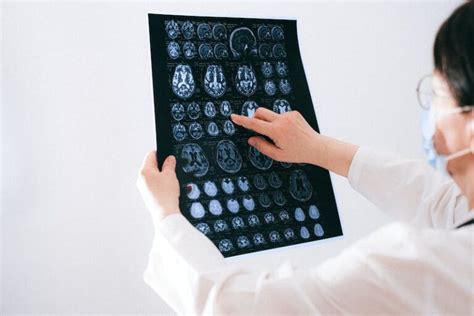Updated Diagnostic Criteria And Nomenclature For Neurofibromatosis Type