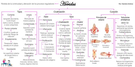 Cuadro Comparativo Tipos De Heridas Udocz Kulturaupice Porn Sex Picture