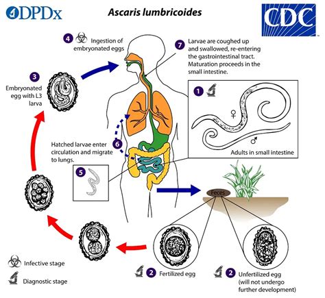 Ascaris Lumbricoides Life Cycle Pathogenesis Lab Diagnosis