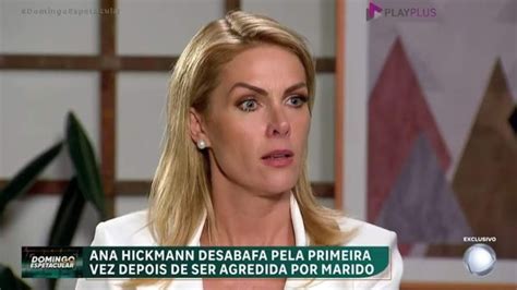 Ana Hickmann Detalha Agress O Em Entrevista Ao Domingo Espetacular