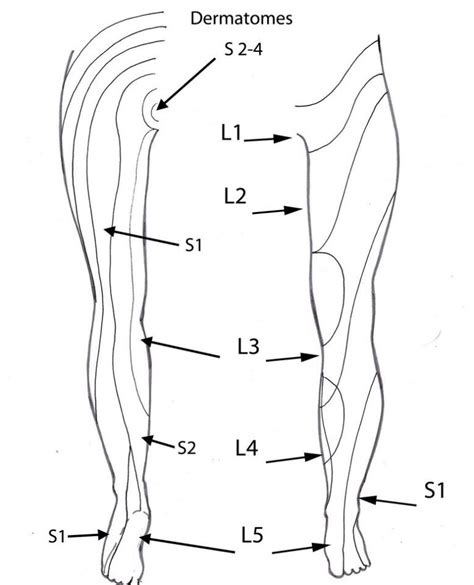 Printable Leg Dermatomes Printable JD