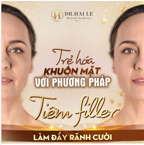 TRẺ HÓA KHUÔN MẶT VỚI PHƯƠNG PHÁP TIÊM FILLER LÀM ĐẦY RÃNH CƯỜI