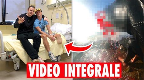 Amputato Da Uno Squalo Accusato Di Truffa Video Integrale Youtube