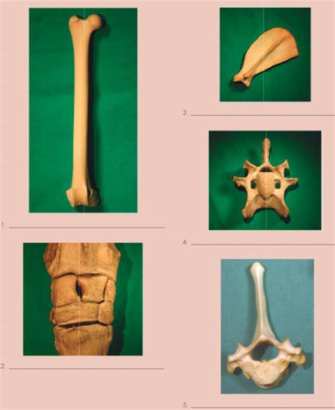 Bone Shapes Diagram Quizlet