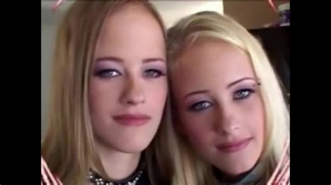 Milton Twins Facts Bio Career Net Worth AidWiki