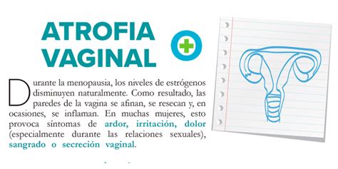 Atrofia Vaginal En La Menopausia Tratamientos