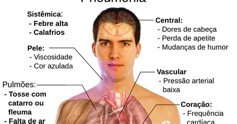 Estudos Em Enfermagem Infogr Fico Pneumonia Principais Sintomas