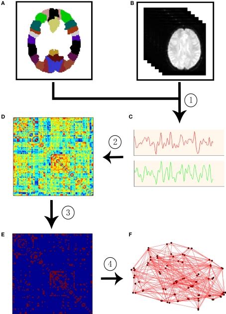 a flowchart for the construction of functional brain network in the download scientific diagram