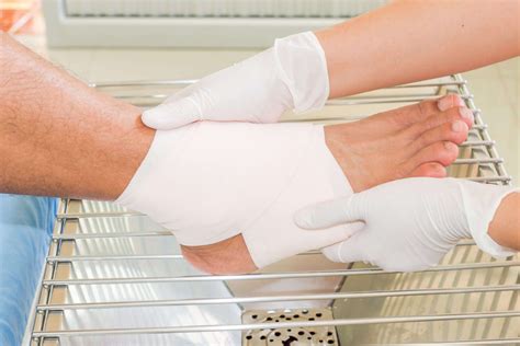 Arterial Ulcer Treatment Management And Wound Care