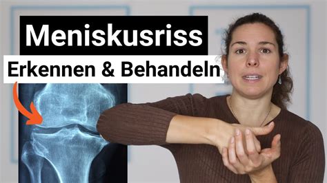 Meniskusriss Alles Was Du Wissen Musst Verletzung OP Reha YouTube