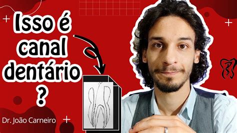Canal dentário Desenho explicativo YouTube