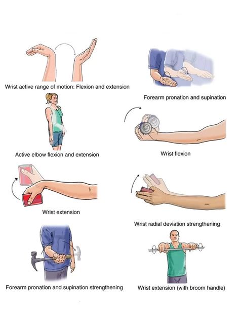 Best Home Exercise For Wrist Drop Mobile Physio