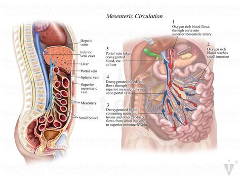 CASE AT A GLANCE Bowel Obstruction Acute Respiratory Distress