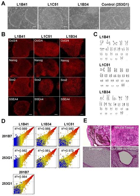 IPS Cells Were Established From Human Corneal Limbal Epithelial Cells