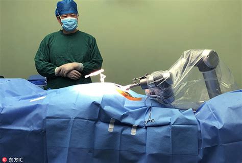 Primeira Cirurgia Rob Tica Na China Um Sucesso