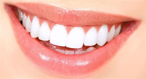 Lente De Contato Dental Incantare Odontologia