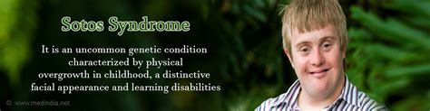 Sotos Syndrome Causes Symptoms Complications Prognosis