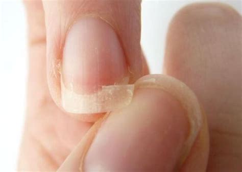 Uñas blandas estas son las causas y los tratamientos más efectivos