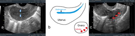 The Normal First Trimester Flashcards Quizlet