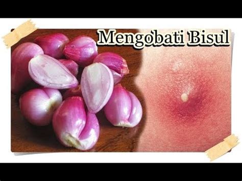 Cara Mengobati Bisul Secara Alami YouTube