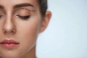 Dermatocálase é um problema estético ou reparador Oftalmologia em