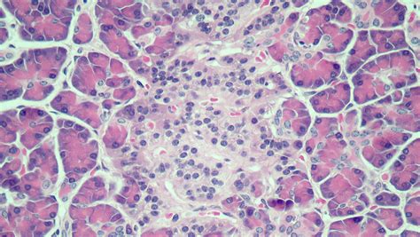 Simply Histology Pancreas Stained With H E A Pancreatic Islet Of