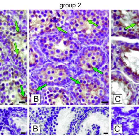 Representative Microphotographs Of Immunohistochemical Localization Of