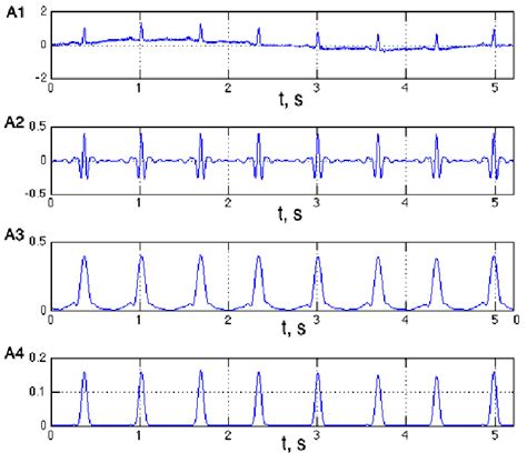 ecg signal processing at different stages of qrs wave detector download scientific diagram