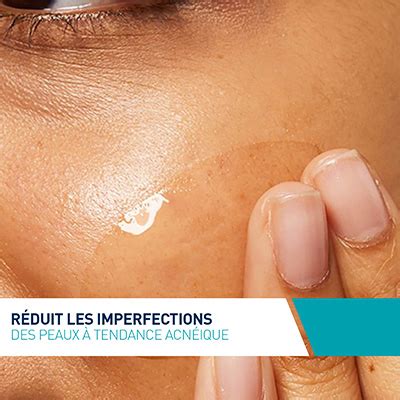 Soin Concentré Anti Imperfections Imperfections CeraVe