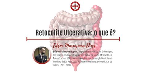 Retocolite Ulcerativa o que é