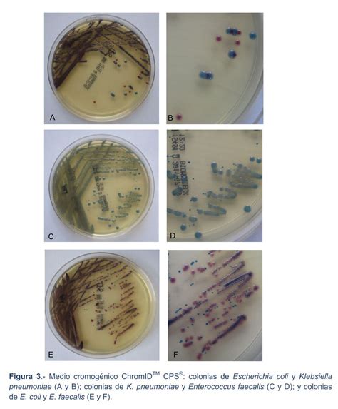 Análisis microbiológico Análisis microbiológico