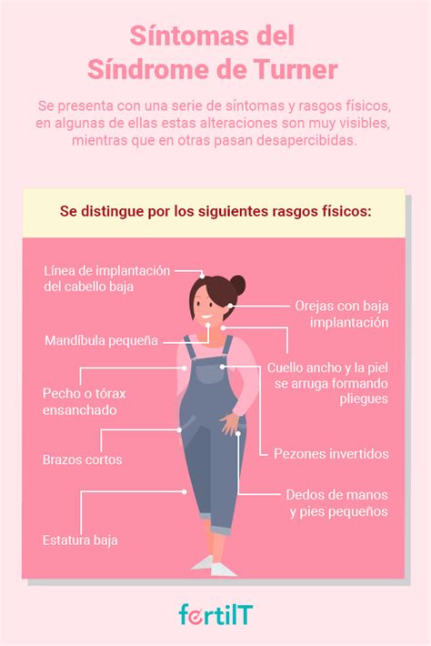 Síndrome de Turner Síntomas Embarazo y fertilidad
