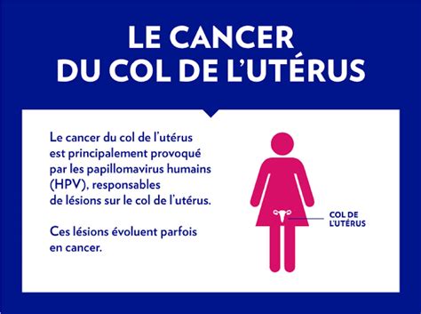 Gr Ce Au Frottis De D Pistage Le Cancer Du Col De Lut Rus Peut Tre