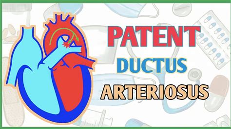 Patent Ductus Arteriosus PDA Pathophysiology Clinical Features