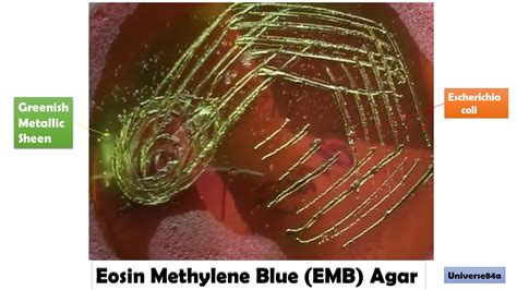 Pseudomonas Aeruginosa Emb Agar