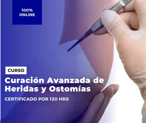 Curso Curación Avanzada de Heridas y Ostomías 120 hrs