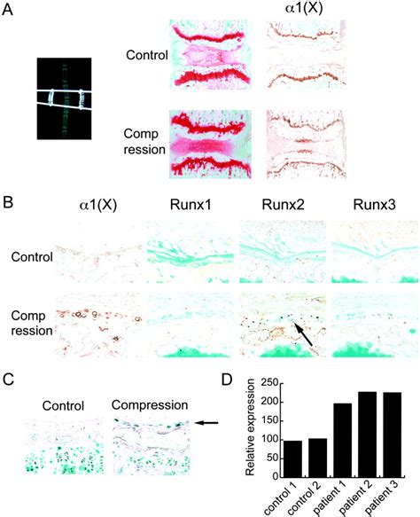 The Distinct Role Of The Runx Proteins In Chondrocyte Differentiation