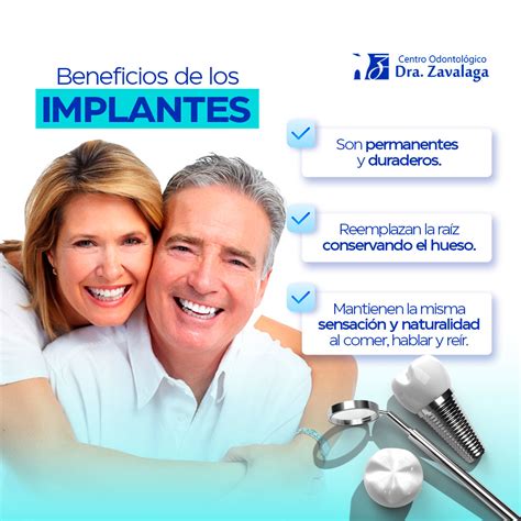 Descubre los beneficios de los implantes Centro Odontológico Dra