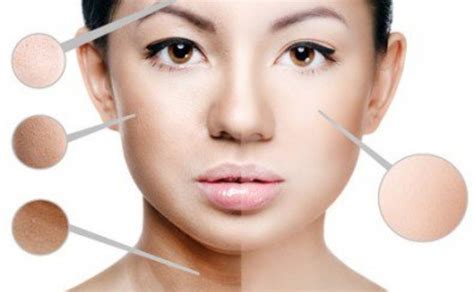 CÓMO ELIMINAR LAS MANCHAS Y LAS PECAS