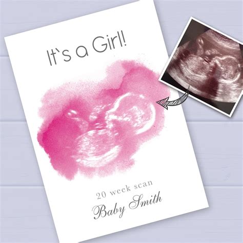 Baby Scan Print Ultrasound Or Sonogram Art Print Baby Scan Etsy