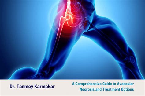 A Comprehensive Guide To Avascular Necrosis And Treatment Options Dr