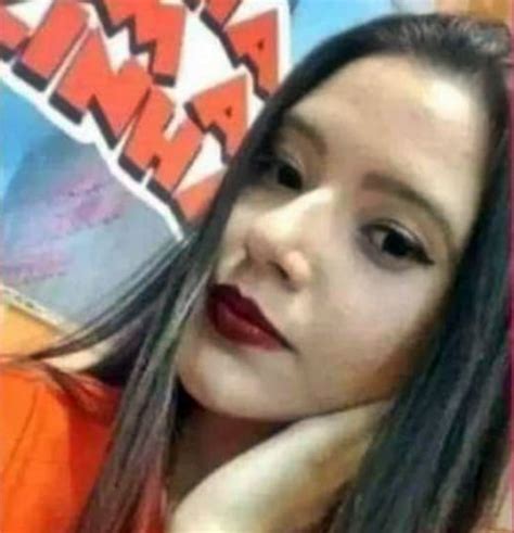 Mulher teve 70 do corpo queimado por companheiro aguarda há 10 dias