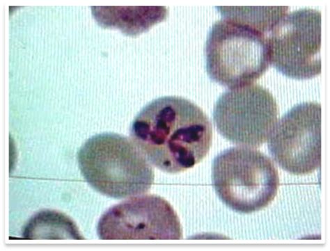 Protozoa Piroplasmids Flashcards Quizlet