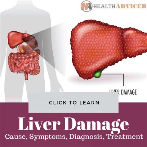 Liver Damage Signs And Symptoms