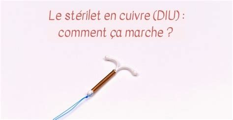 Stérilet DIU en cuivre pour qui et comment ça fonctionne
