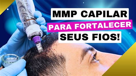 Descubra por que o MMP Capilar é altamente indicado em casos de