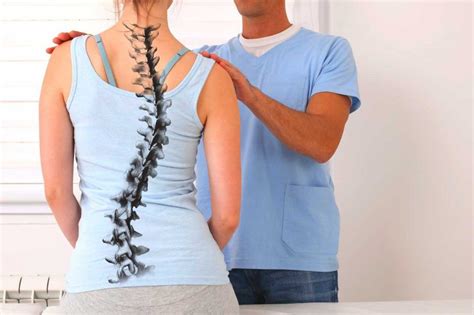 Escoliosis Tipos y características Todo los que tienes que saber